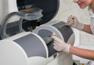 CEREC Same Day Dental Crowns and Bridges La Mesa San Diego CA